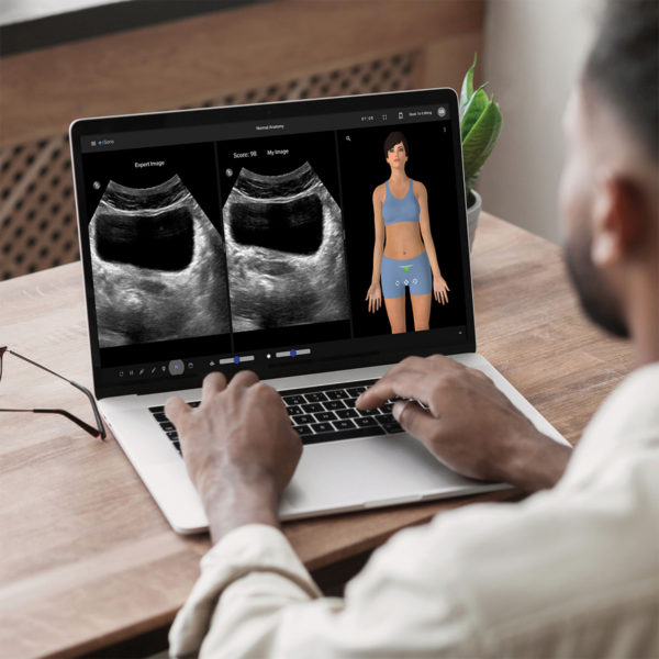 e Sono Ultrasound Simulator